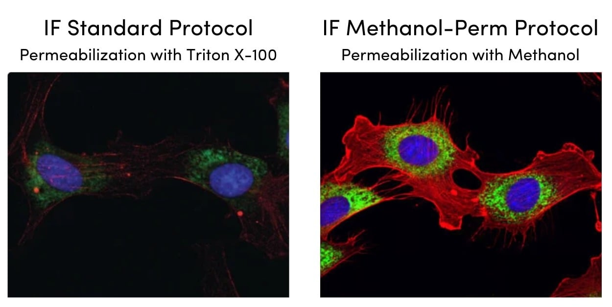 Successful Immunofluorescence: Fixation & Permeabilization | CST Blog
